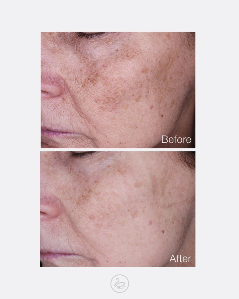 EXPERT LAB – Pigment Therapy Treatment - The Face & Body Clinic Ltd